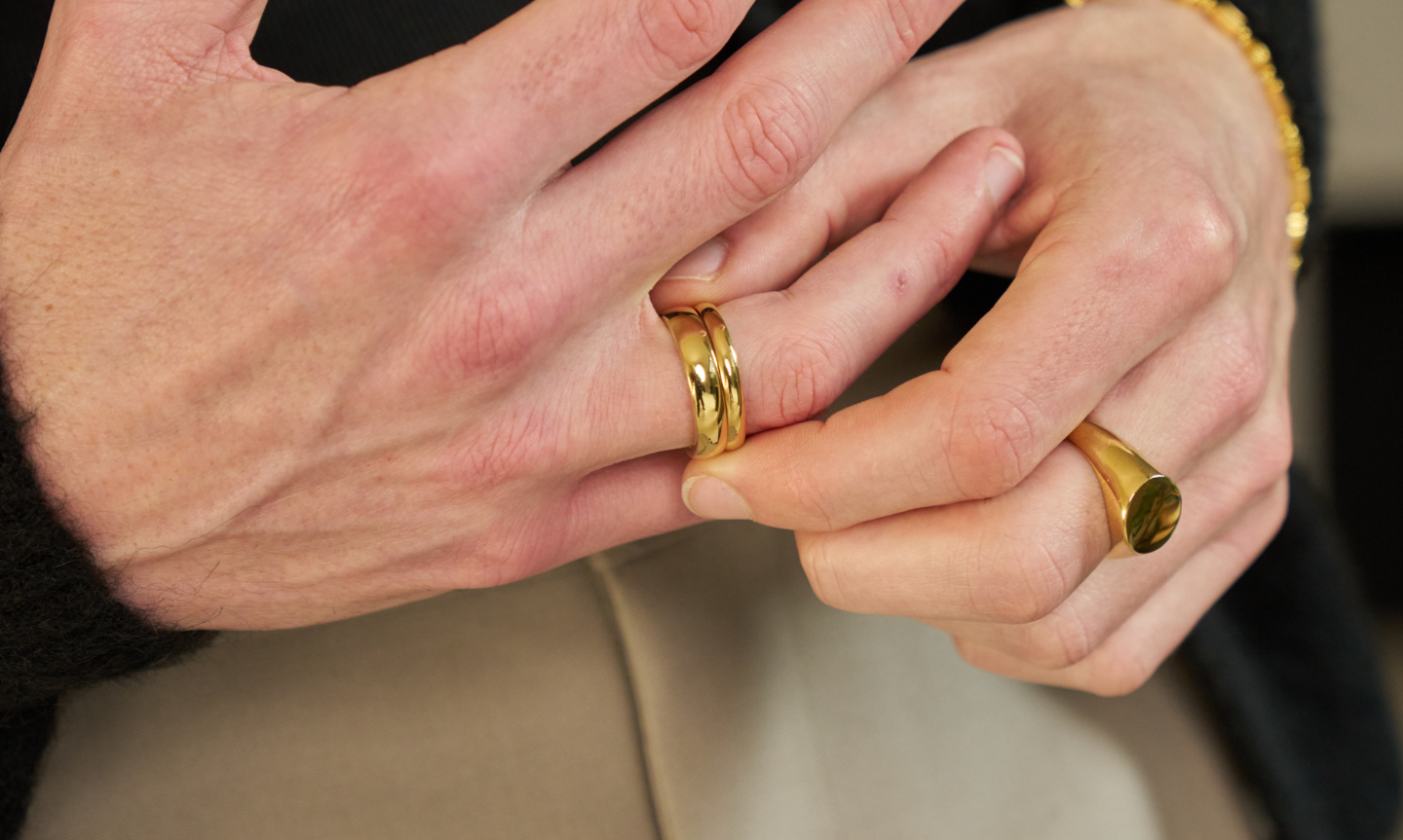 how long do wedding ring marks last